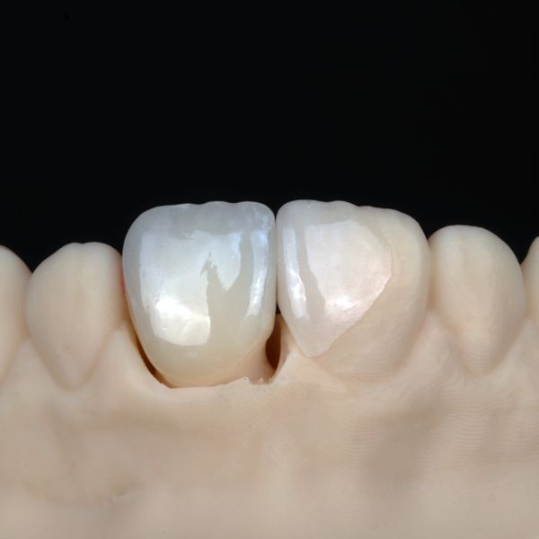 The French Tooth Website and Portal